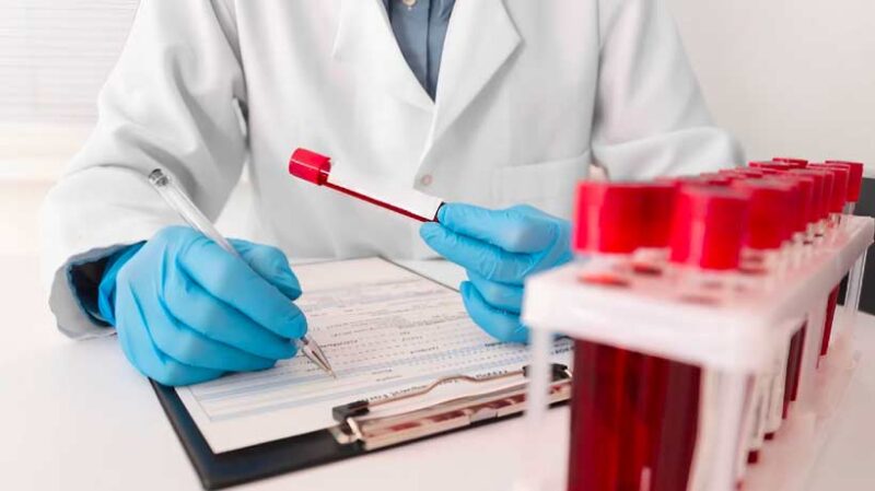 Hemograma Completo, porque es importante. – Laboratorio Domecq & Lafage